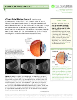 fact_sheet_choroidal_detachment | Retina Specialists of North Alabama, LLC