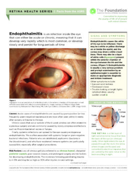 fact_sheet_endophthalmitis | Retina Specialists of North Alabama, LLC