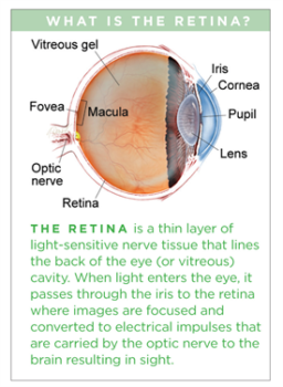 Posterior Vitreous Detachment | Retina Specialists of North Alabama, LLC
